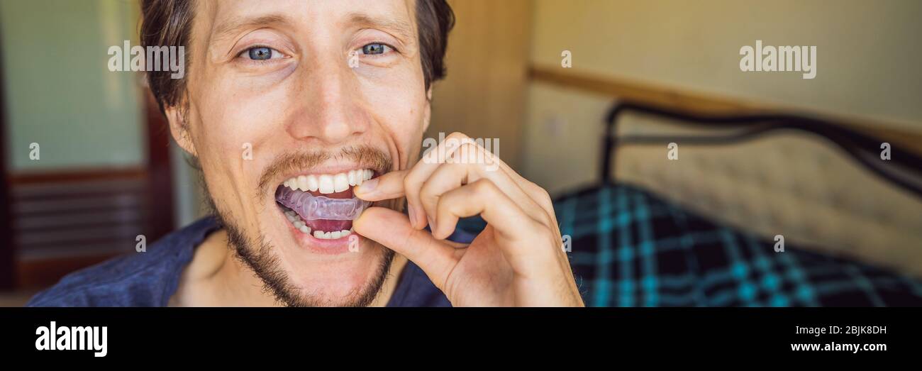 Man placing a bite plate in his mouth to protect his teeth at night ...