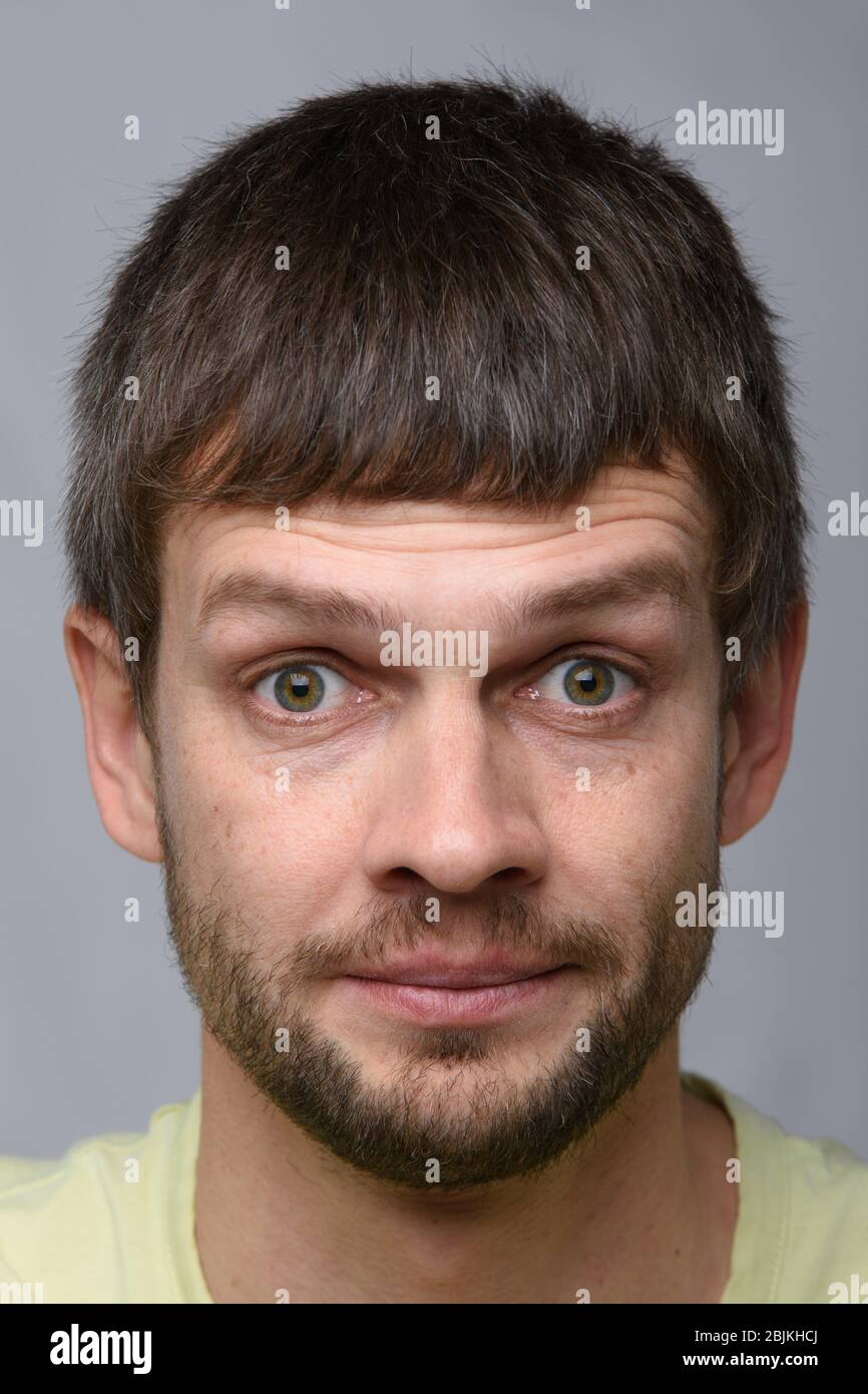Close-up portrait of a man with bulging eyes of European appearance ...