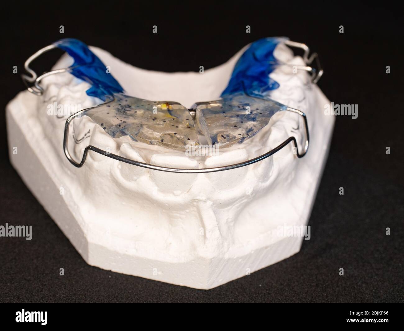 Plaster cast of teeth with removable partial orthodontic removable ...