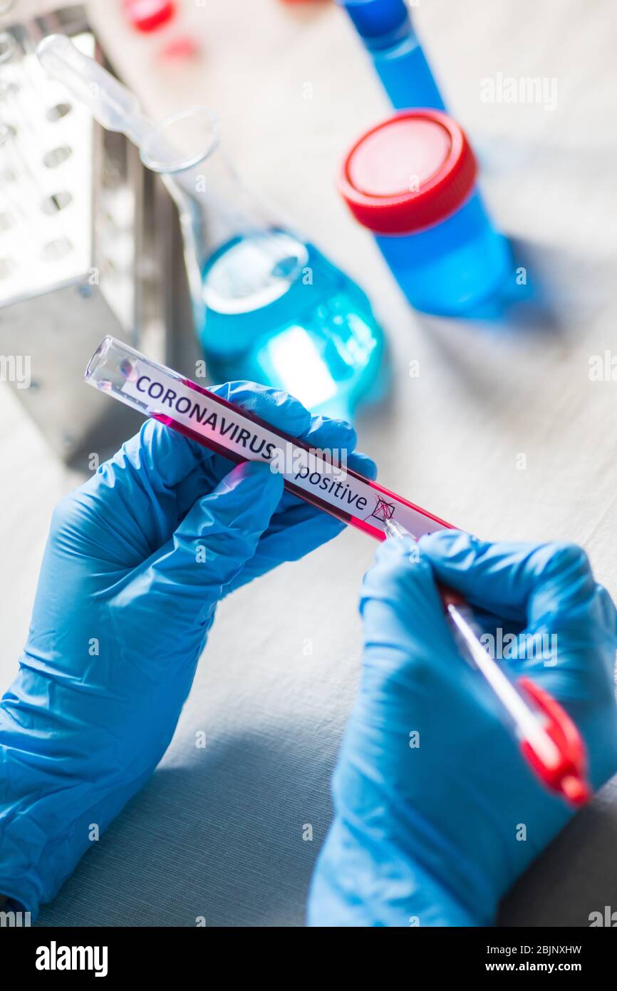 Conceptual photograph of a doctor's hands holding and marking a test ...