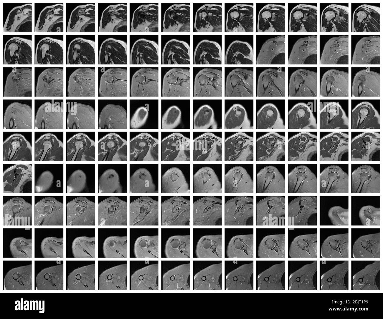 Shoulder anatomy hi-res stock photography and images - Alamy