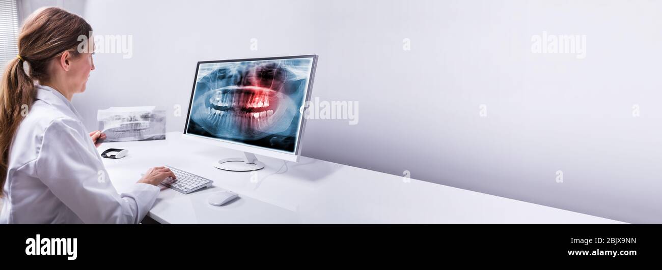 Dentist Looking At Teeth Xray Scan On Computer Stock Photo - Alamy
