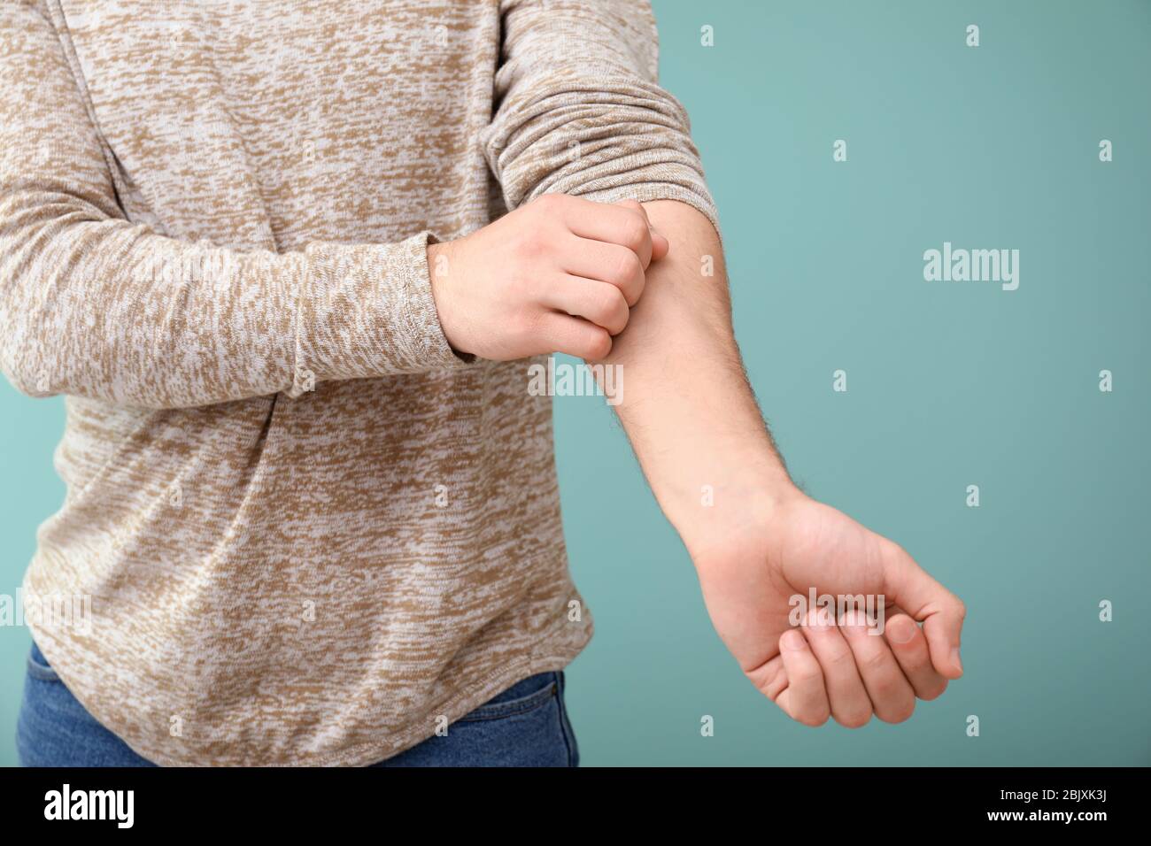 Hand allergy suffering skin hi-res stock photography and images - Alamy