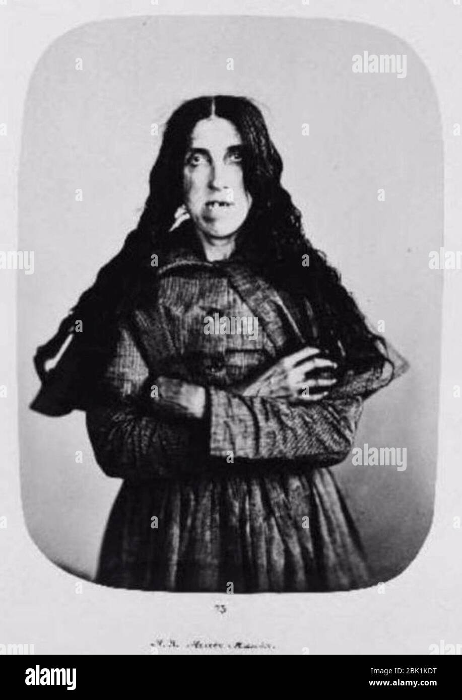 Acute mania hi-res stock photography and images - Alamy