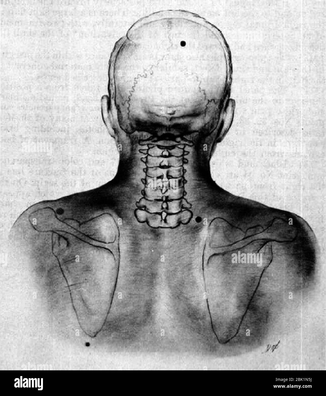 Hsca hi-res stock photography and images - Alamy