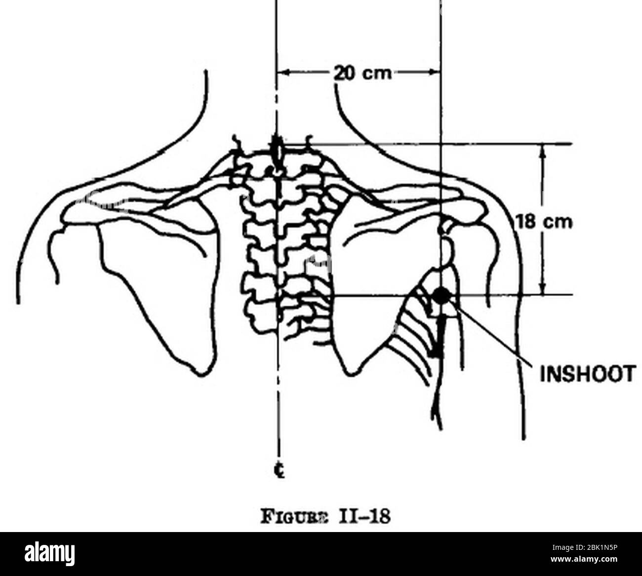 Hsca hi-res stock photography and images - Alamy