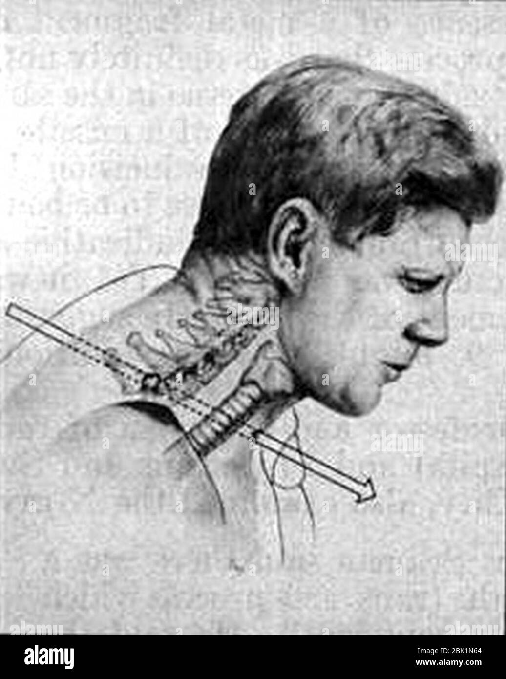 Hsca hi-res stock photography and images - Alamy