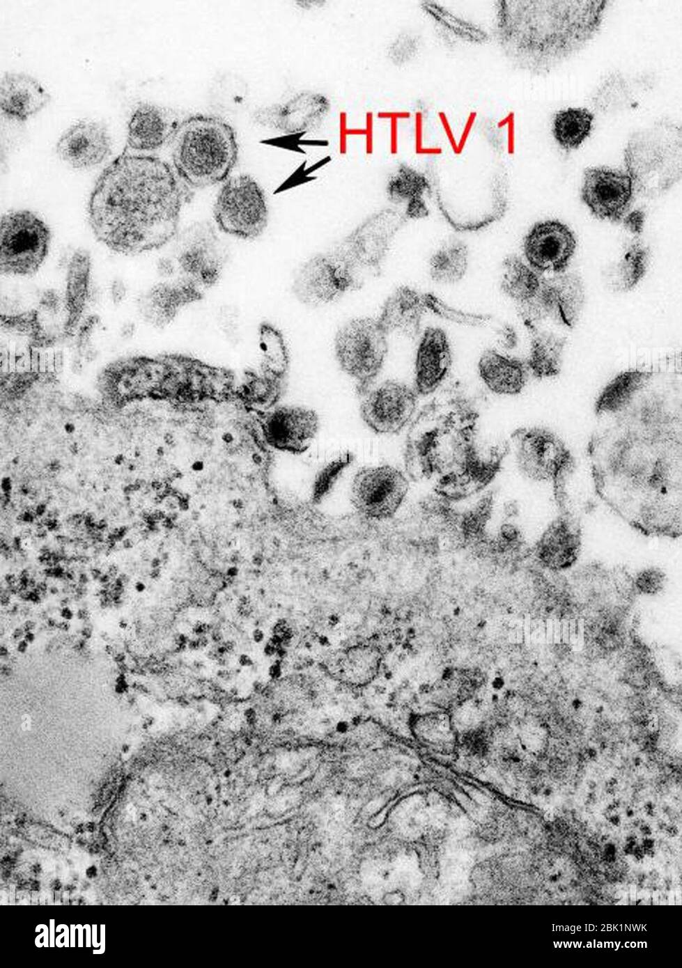 Htlv hi-res stock photography and images - Alamy