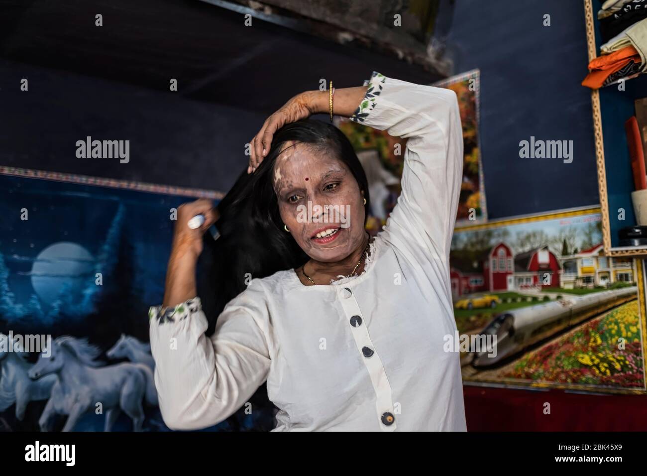 Scars Arm High Resolution Stock Photography and Images - Alamy