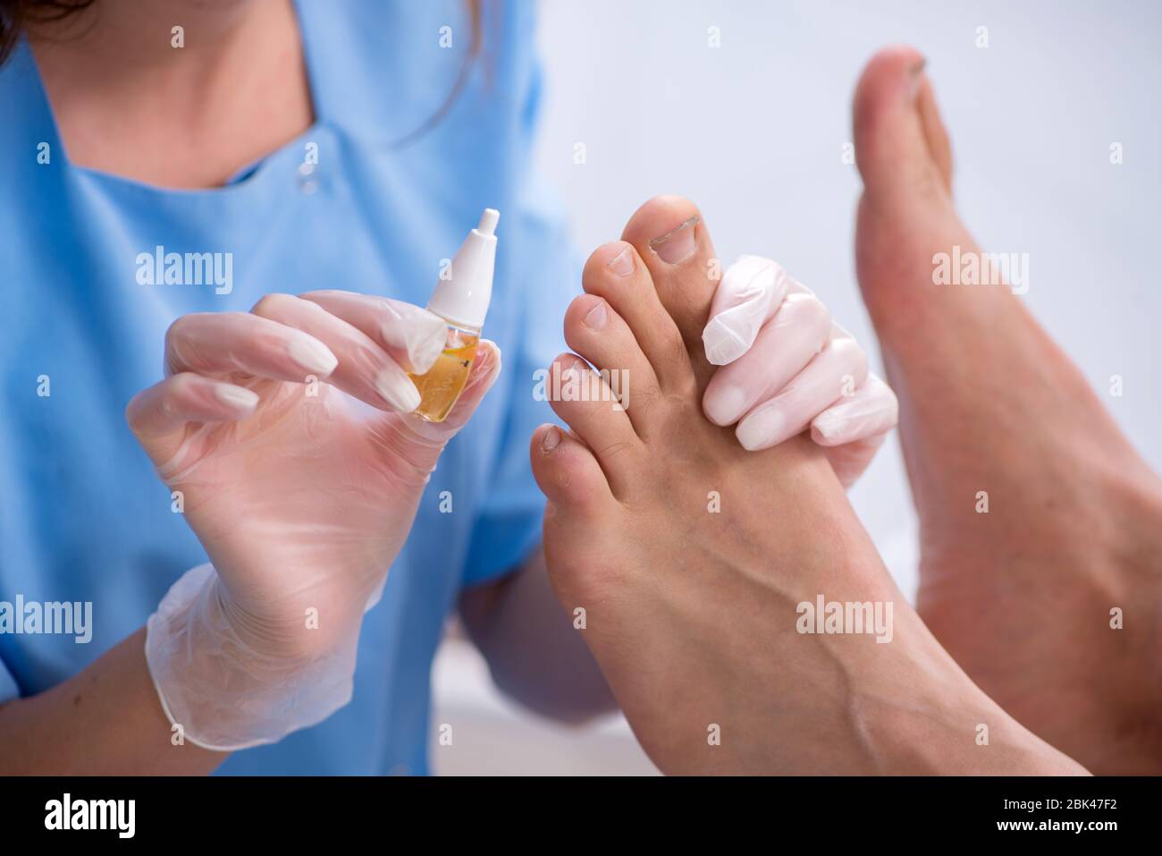 Podiatrist treating feet during the procedure Stock Photo - Alamy