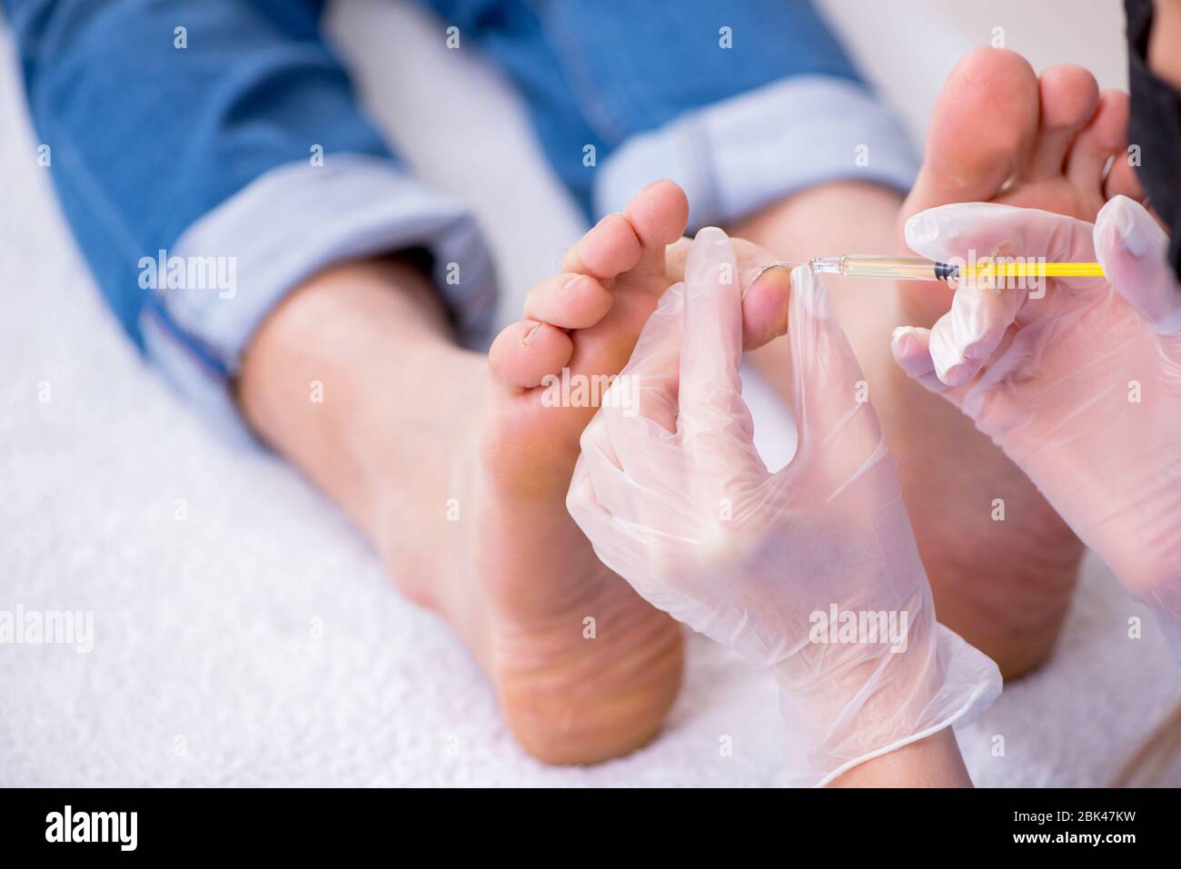 Podiatrist treating feet during the procedure Stock Photo - Alamy