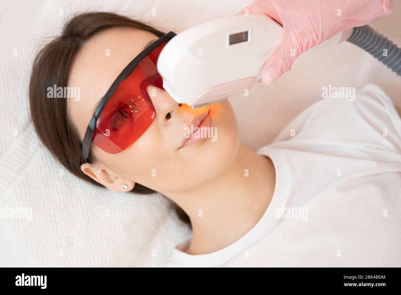 Removal of unwanted hair laser Epilation on face mustache young woman ...