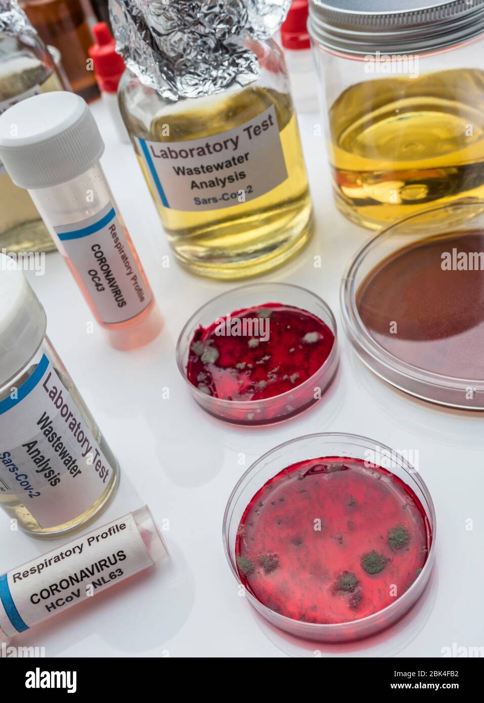 Bacteriological petri-disk culture with wastewater samples, analysis of ...
