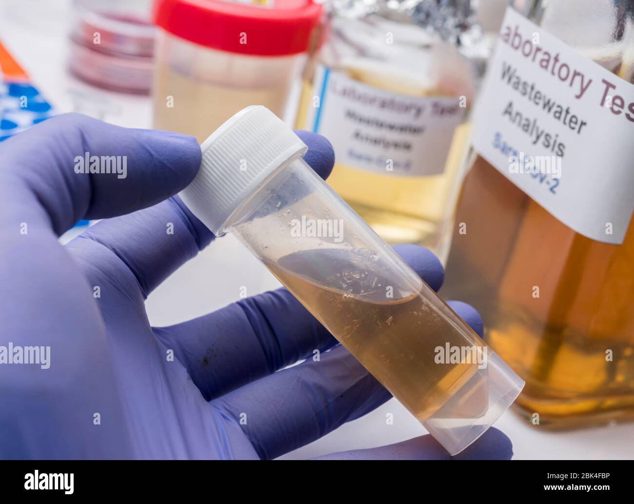 Scientific analysis of wastewater sample in laboratory, investigation ...