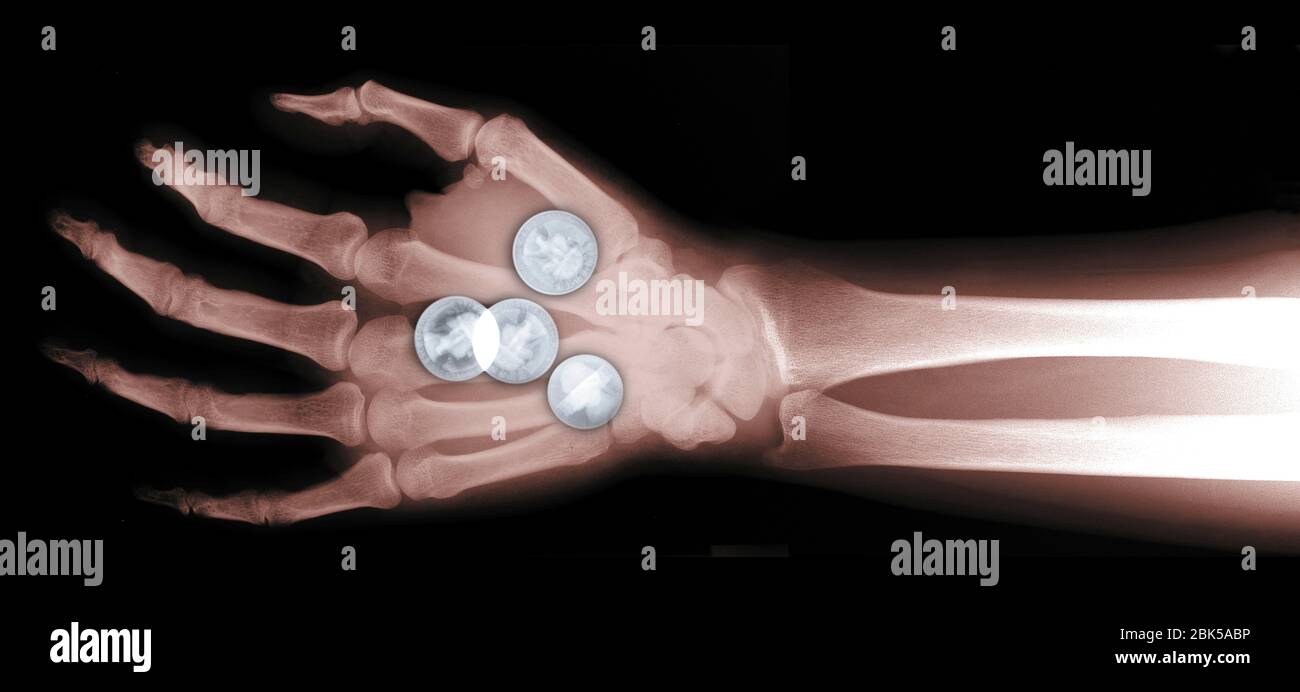 Hand holding coins, coloured X-ray Stock Photo - Alamy