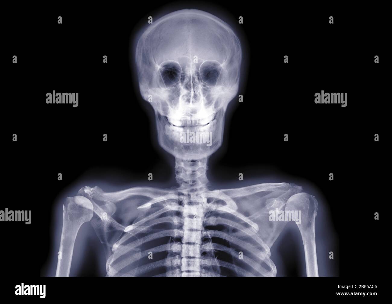 Skull and shoulders smiling, X-ray Stock Photo - Alamy