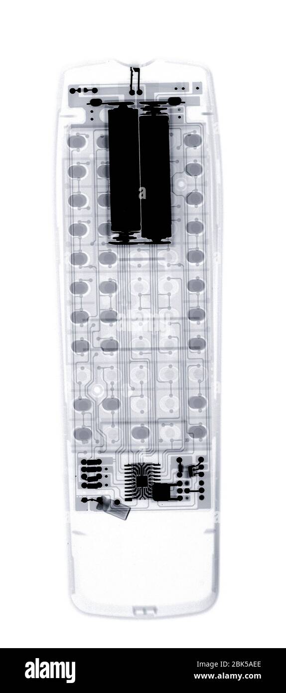 Remote control, X-ray Stock Photo - Alamy