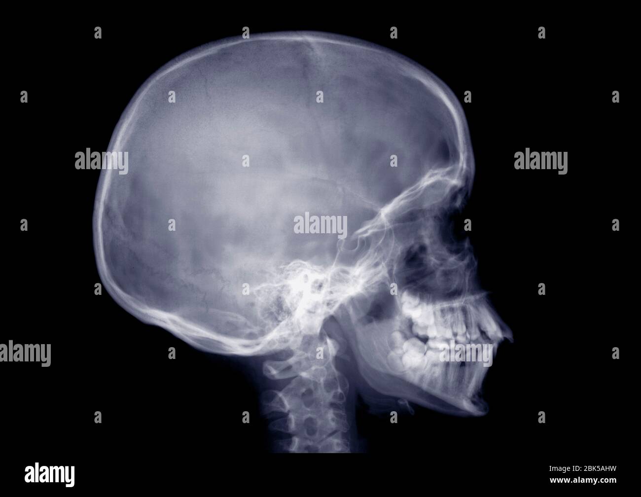 Human head side view hi-res stock photography and images - Alamy