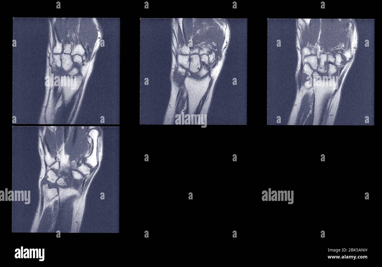 Medical scans hi-res stock photography and images - Alamy