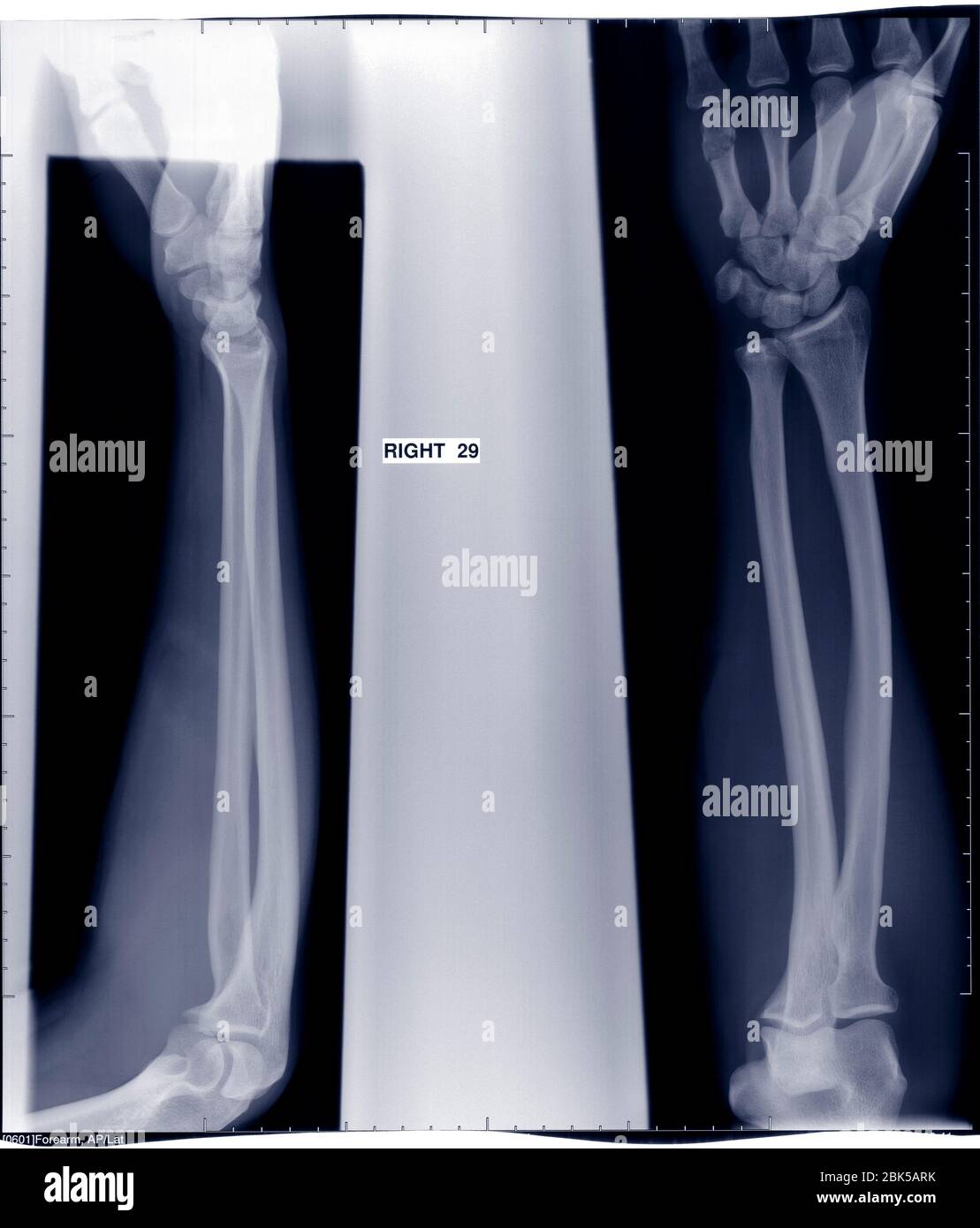 Arms anatomical hi-res stock photography and images - Alamy