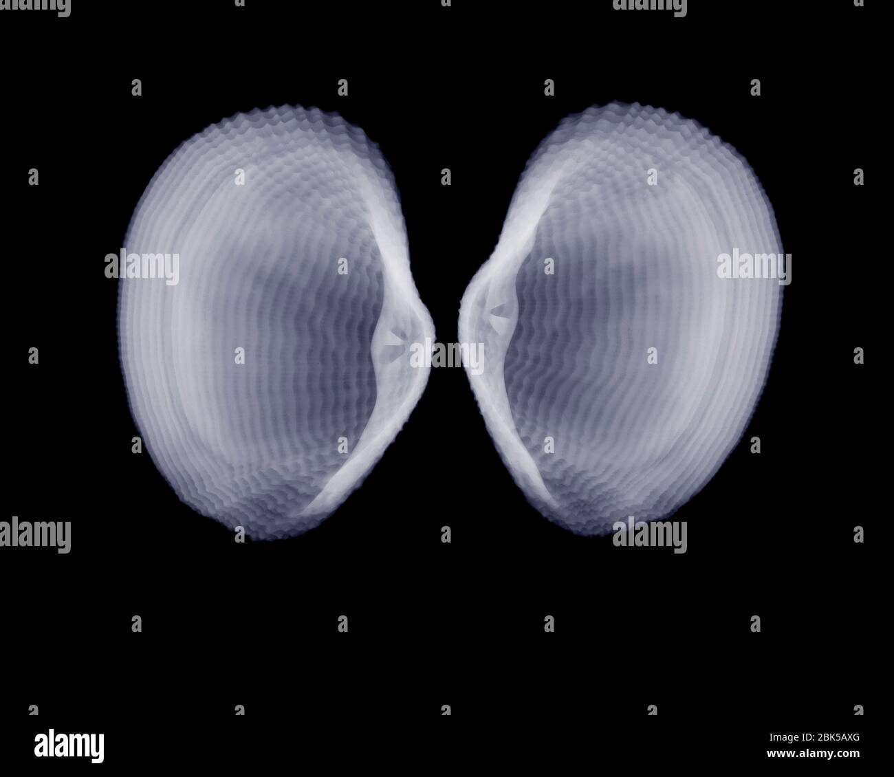 Shells (Astarte sulcata), X-ray Stock Photo - Alamy