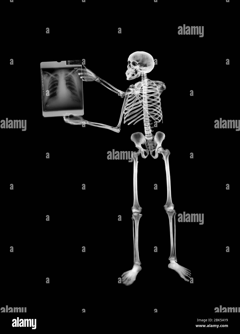 Human body xray full body hi-res stock photography and images - Alamy