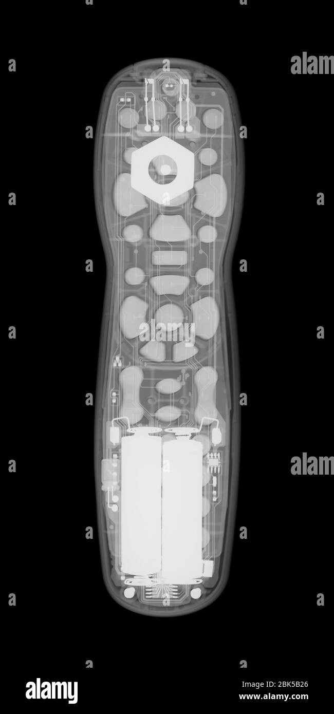 Remote control, X-ray Stock Photo - Alamy