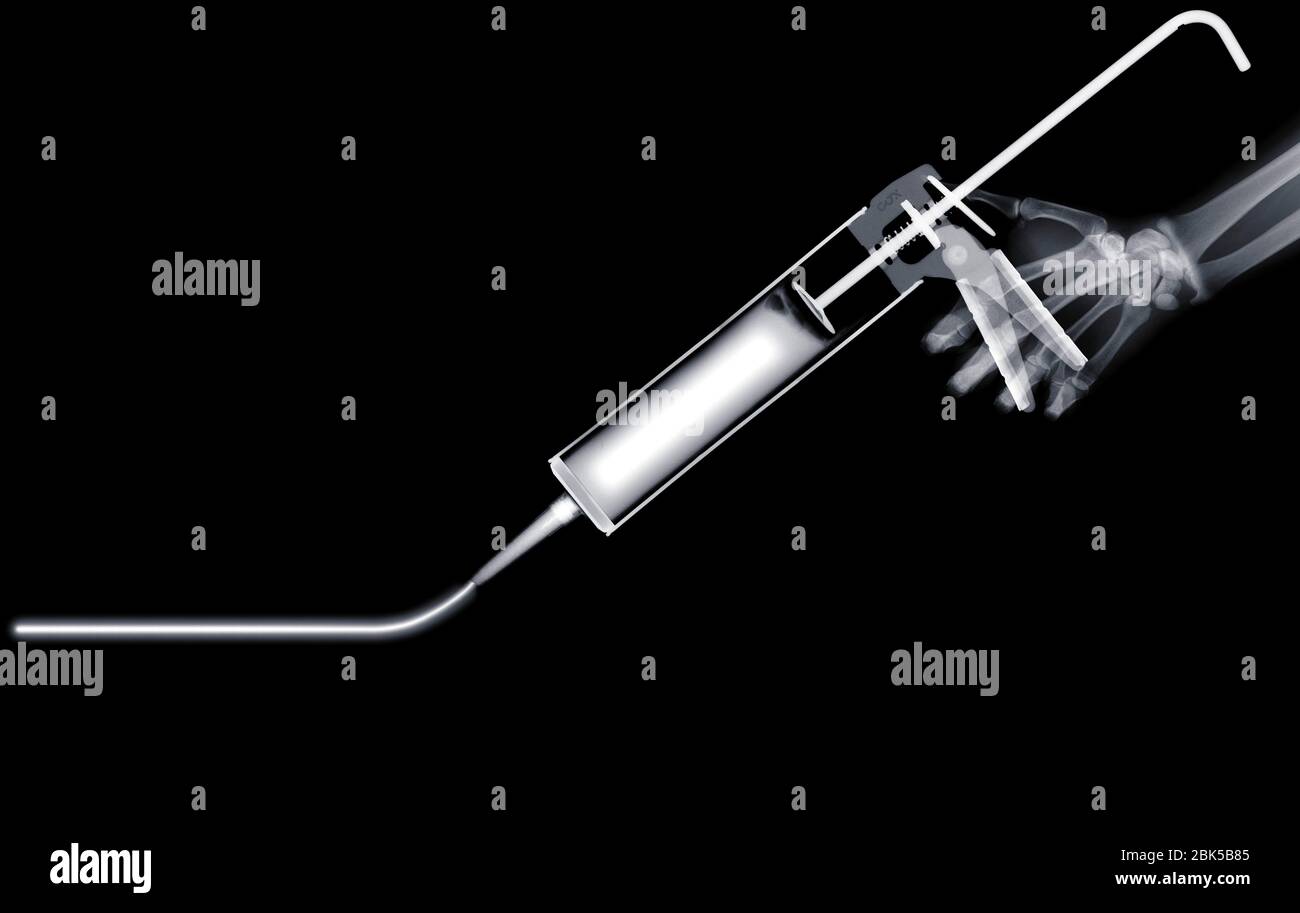 X ray of gun hi-res stock photography and images - Alamy