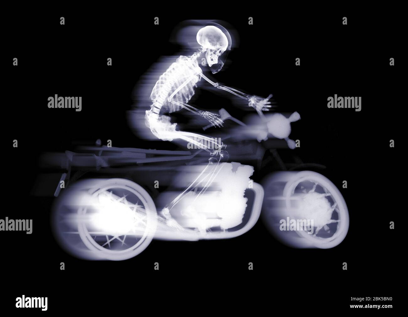 Person riding a motorcycle, X-ray Stock Photo - Alamy