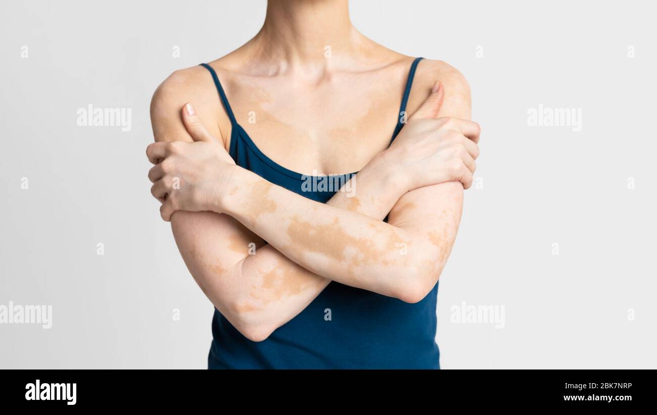 Problems of person with different appearance, panorama Stock Photo - Alamy