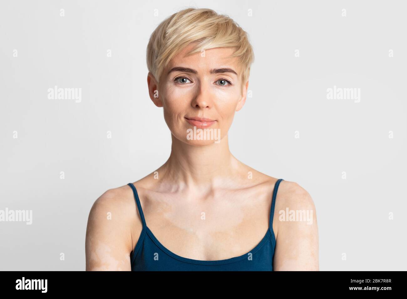 Autoimmune diseases hi-res stock photography and images - Alamy