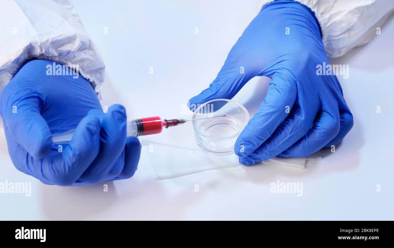 Laboratory assistant hold syringe with blood. Close up Stock Photo - Alamy