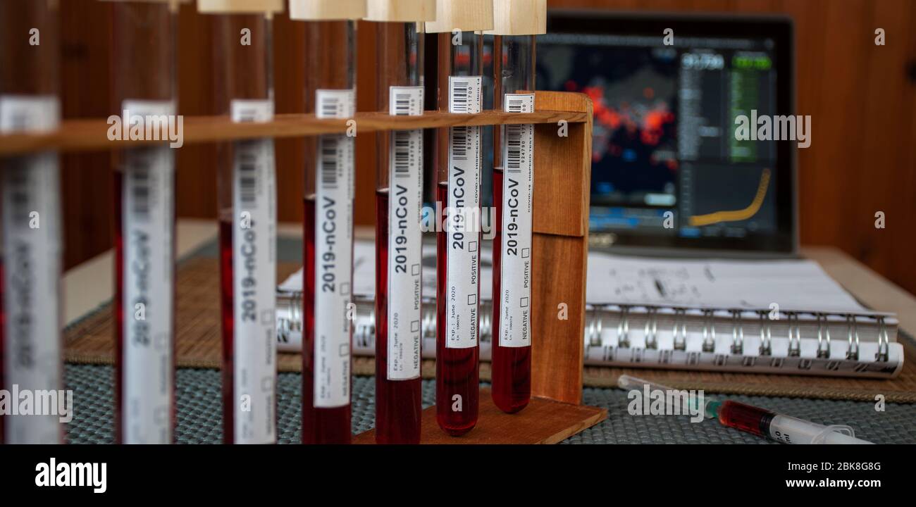 Coronavirus COVID-19 hi-speed blood test samples on the desk in ...