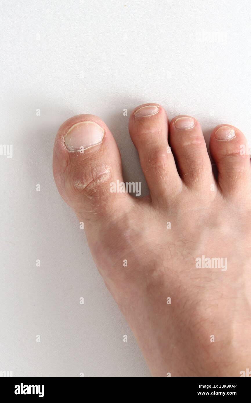 Mans foot on a white background. The leg of a white man. Big toe ...