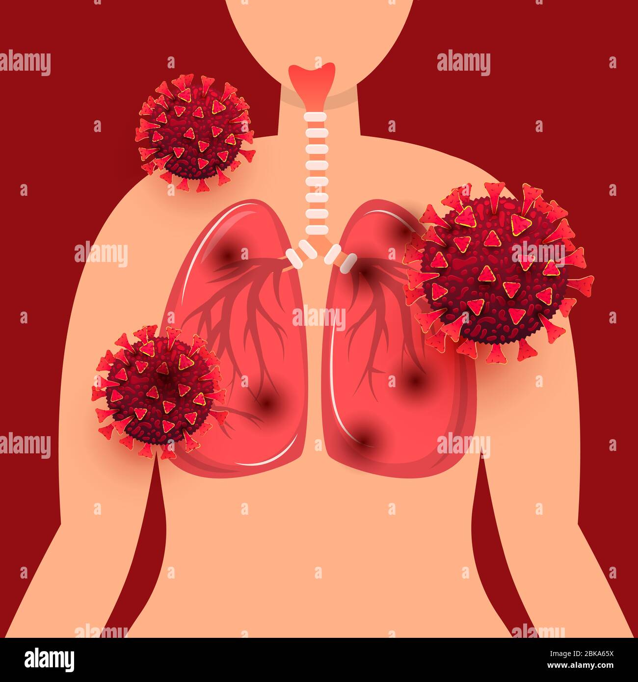 Human lungs infected with coronavirus covid 19 infection concept on red ...