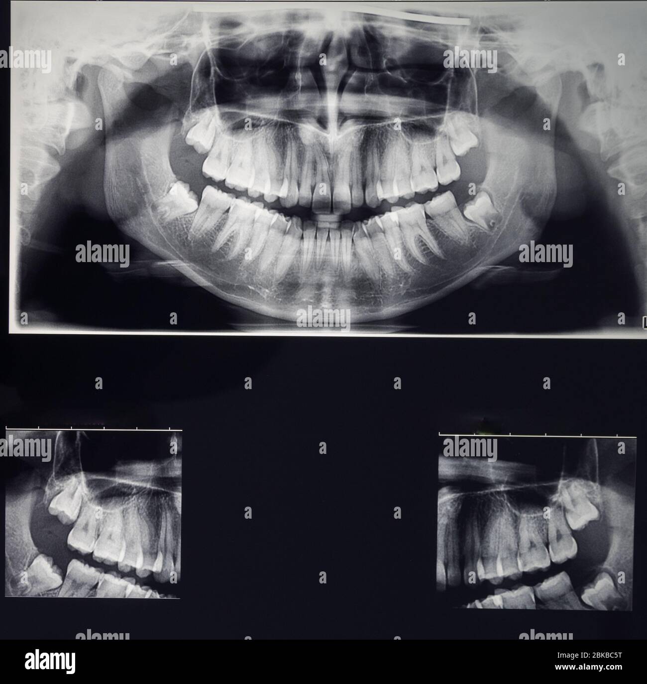 odontostomalogical radiographs, digital orthopantomography for dental ...