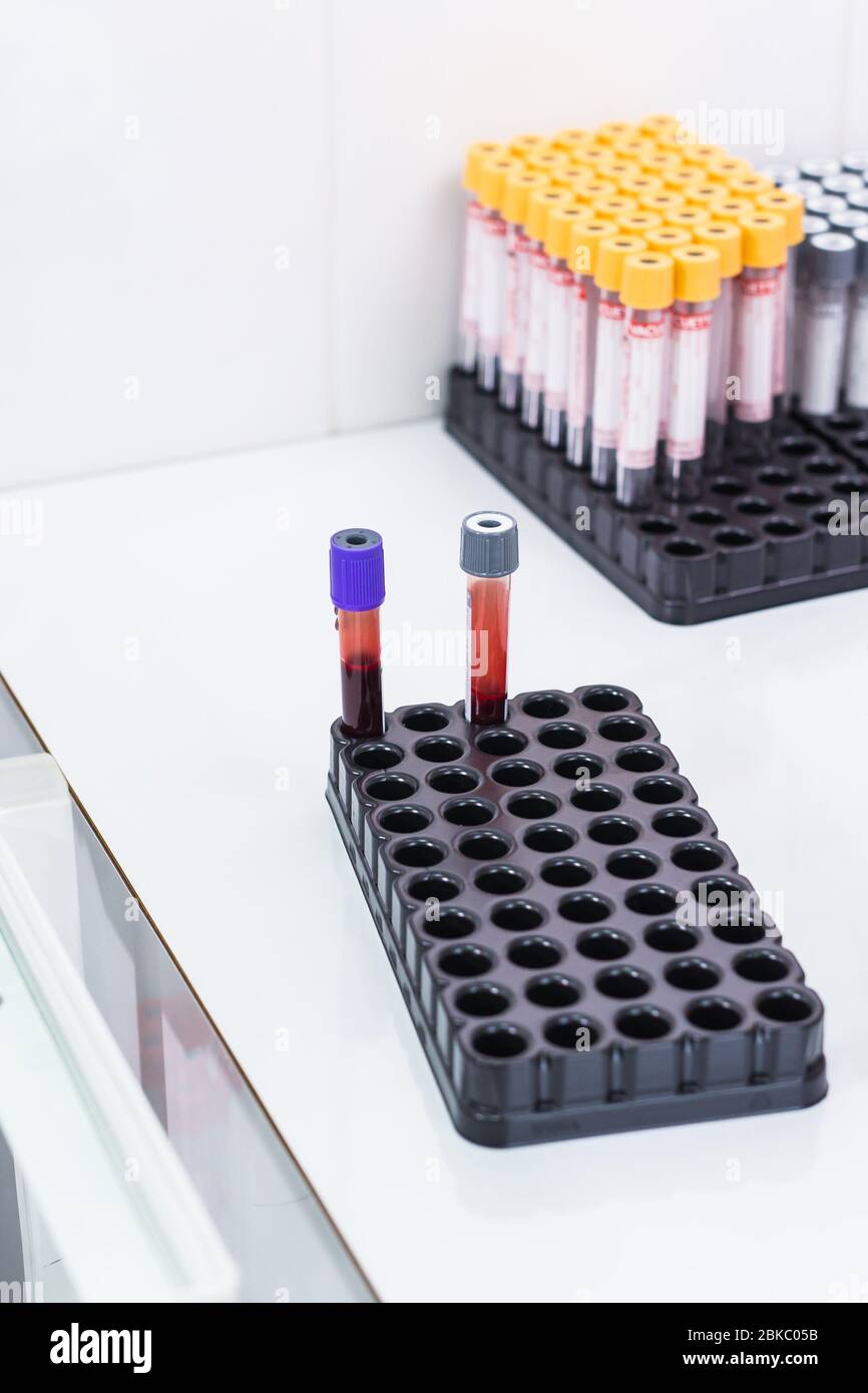 Covid-19, pandemic and coronavirus concept - blood in tests tubes in ...