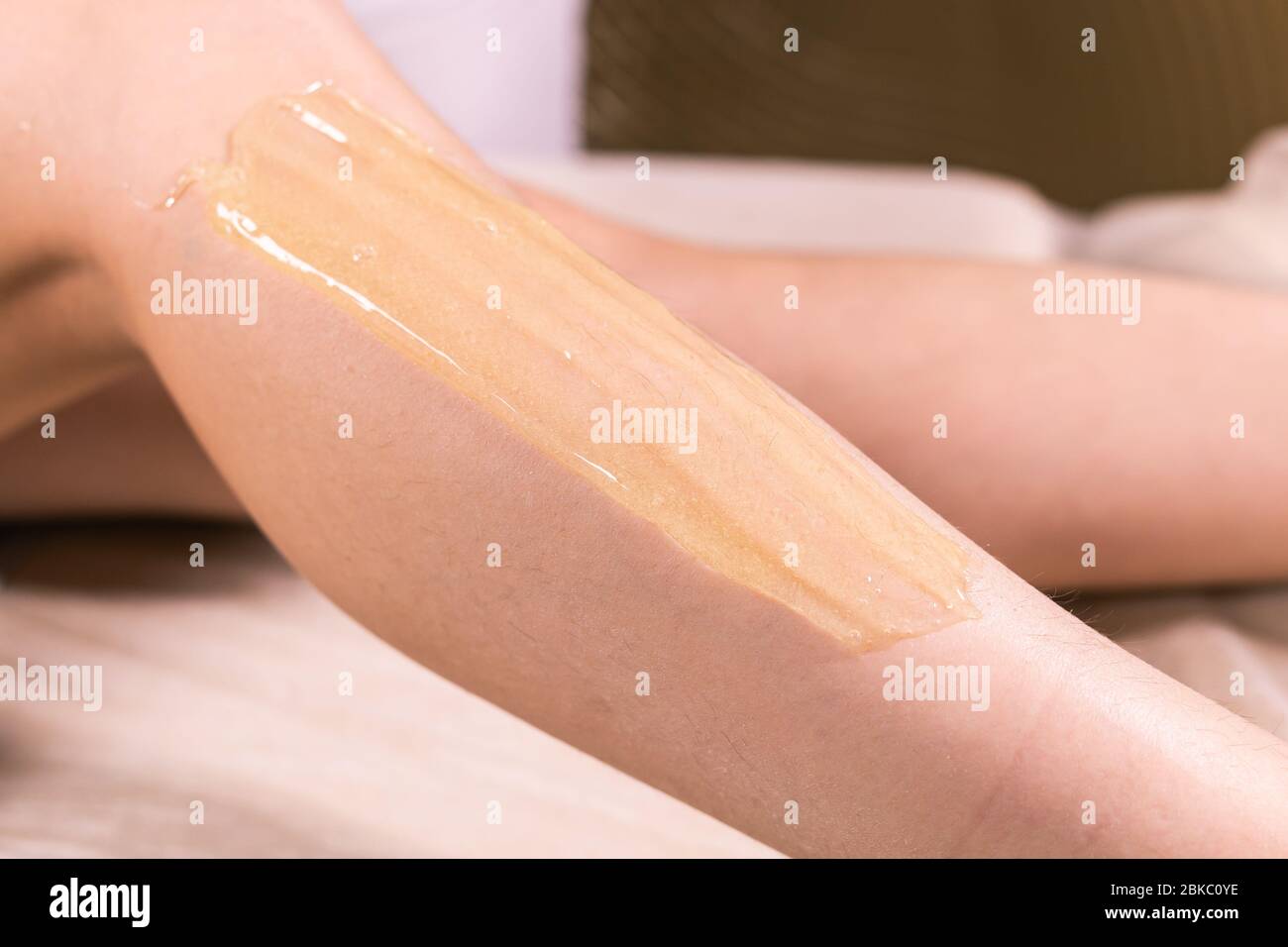 Sugaring processing, epilation with liquate sugar at legs, close-up ...
