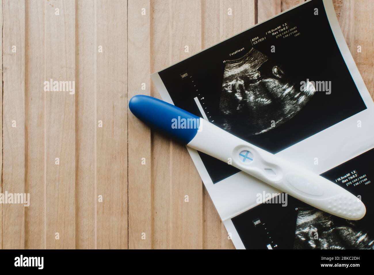 Ultrasound test hi-res stock photography and images - Alamy