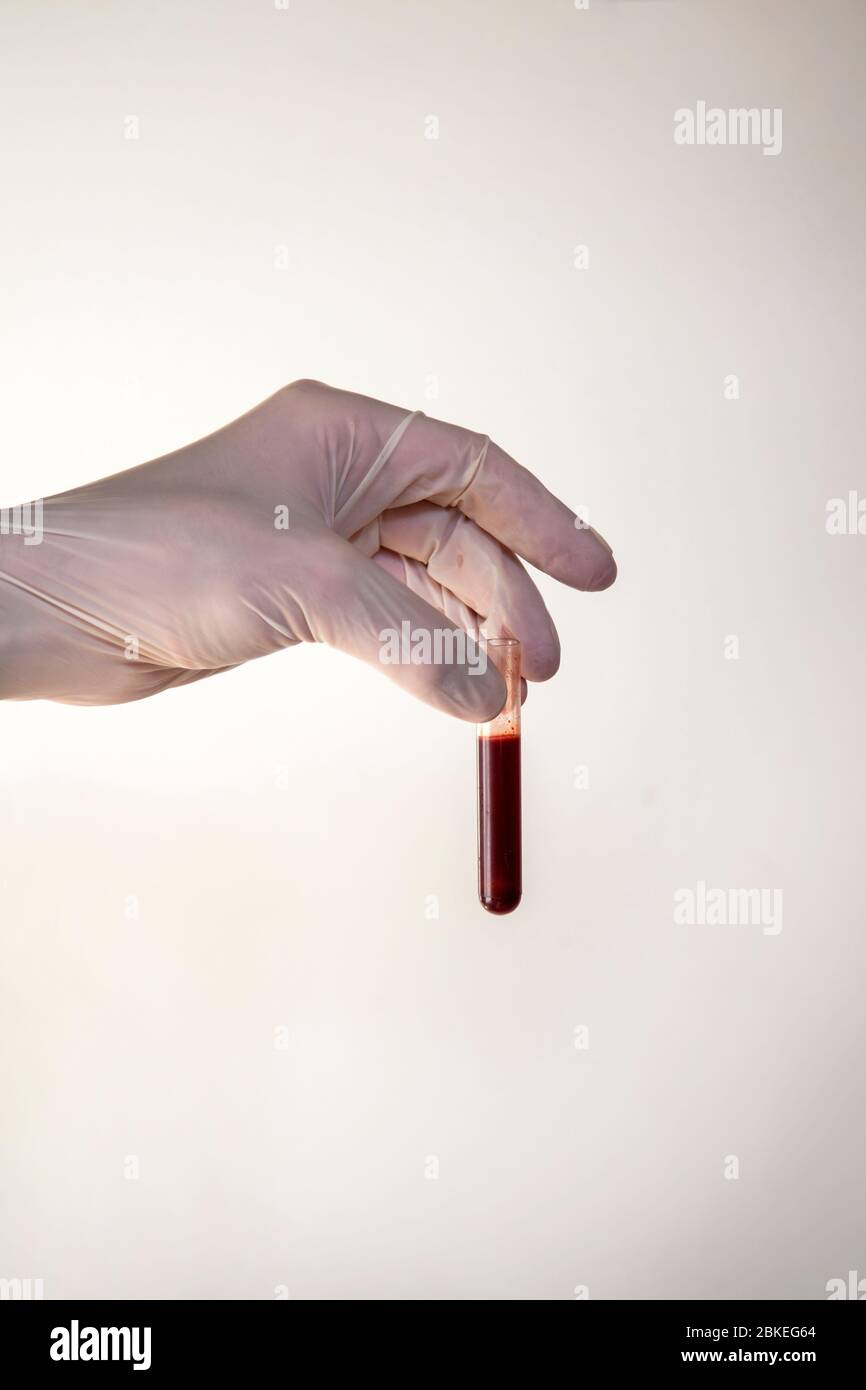 Gloved Hand Holding Blood Vial Stock Photo - Alamy