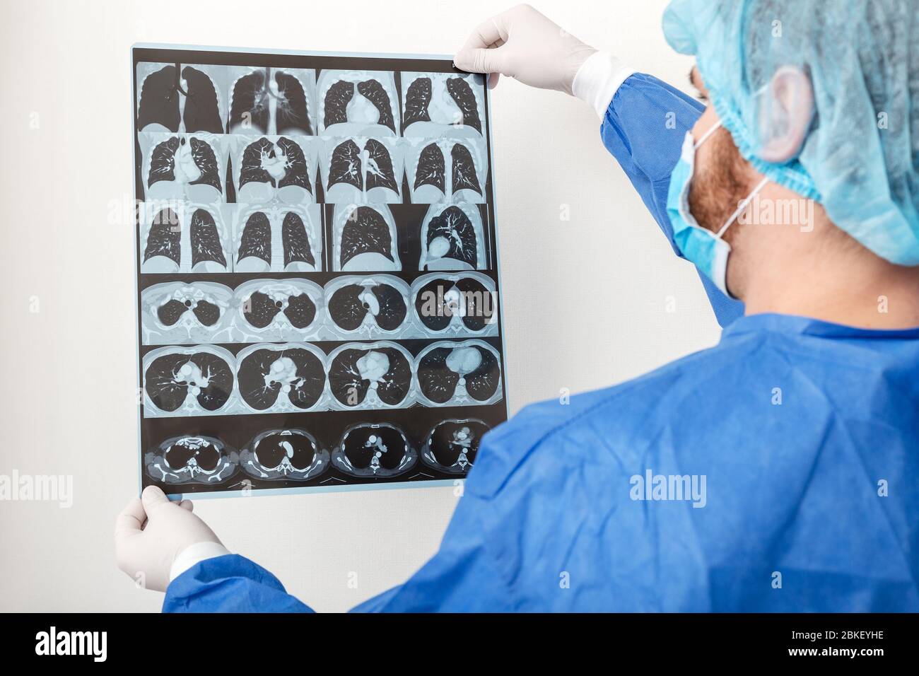 Doctor surgeon in protective uniform check up x ray film of MRI lungs ...
