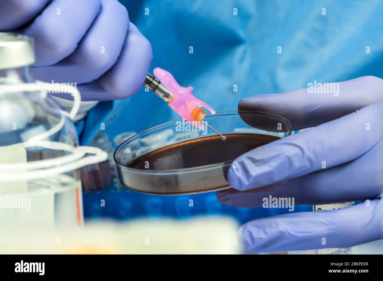 Nurse prepares blood culture in a petri dish prepared for experiment ...