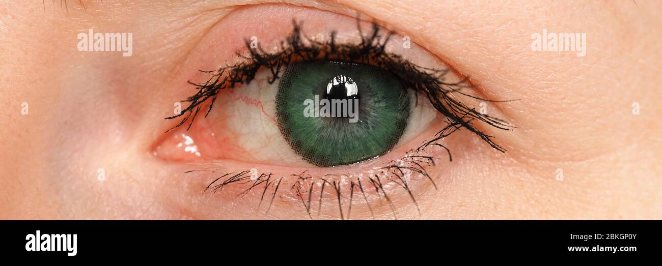 Female left blue eye tinted in green colour with special contact lens ...