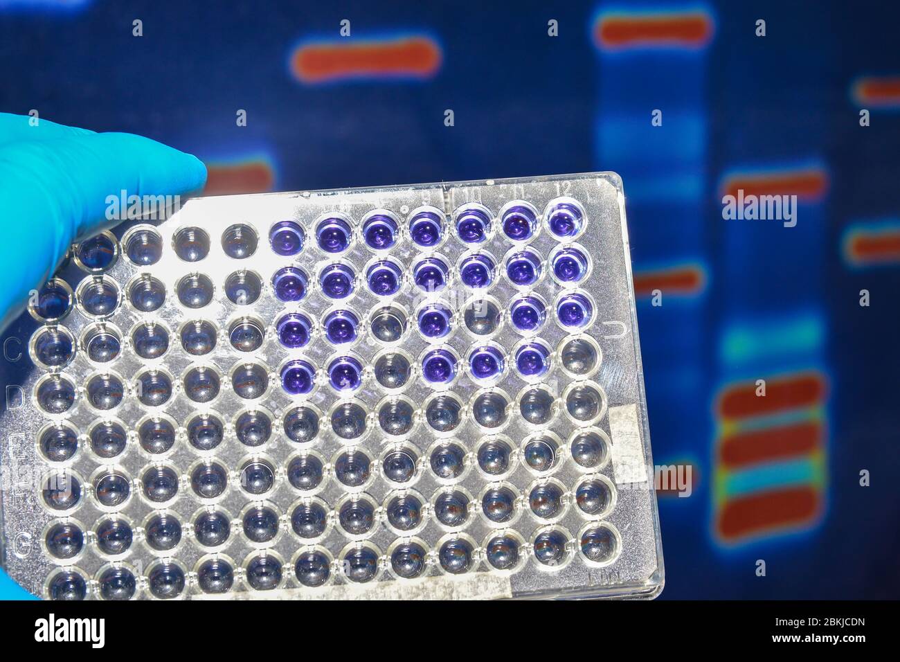 Laboratory DNA testing. 96-well plate on the background of the image of ...