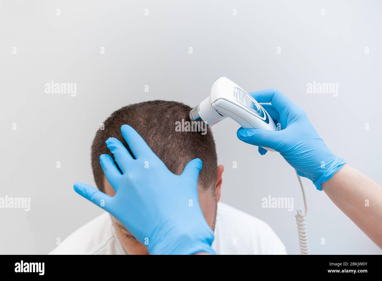 Trichoscopy of hair and scalp closeup. Trichoscope in the hands of a ...