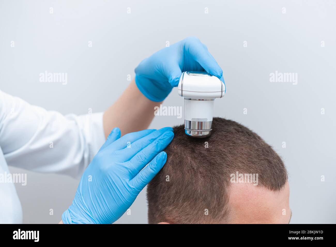 Trichoscopy of hair and scalp closeup. Trichoscope in the hands of a ...