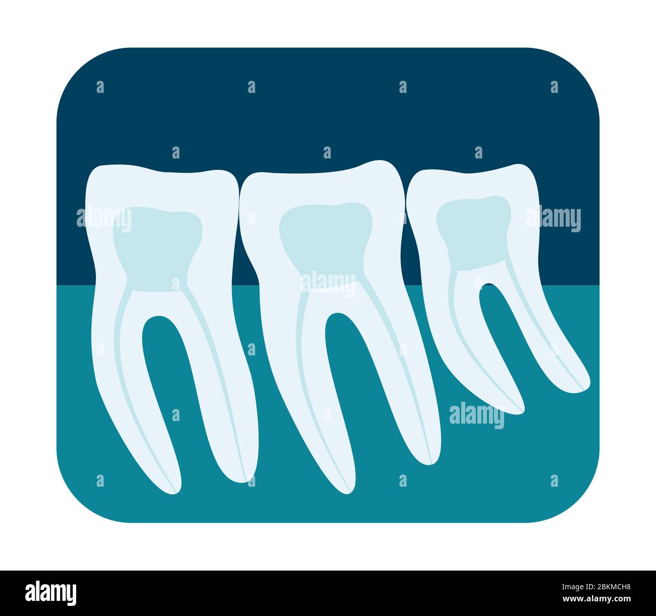 X-ray of human teeth. Three healthy molars on an x-ray. Vector ...
