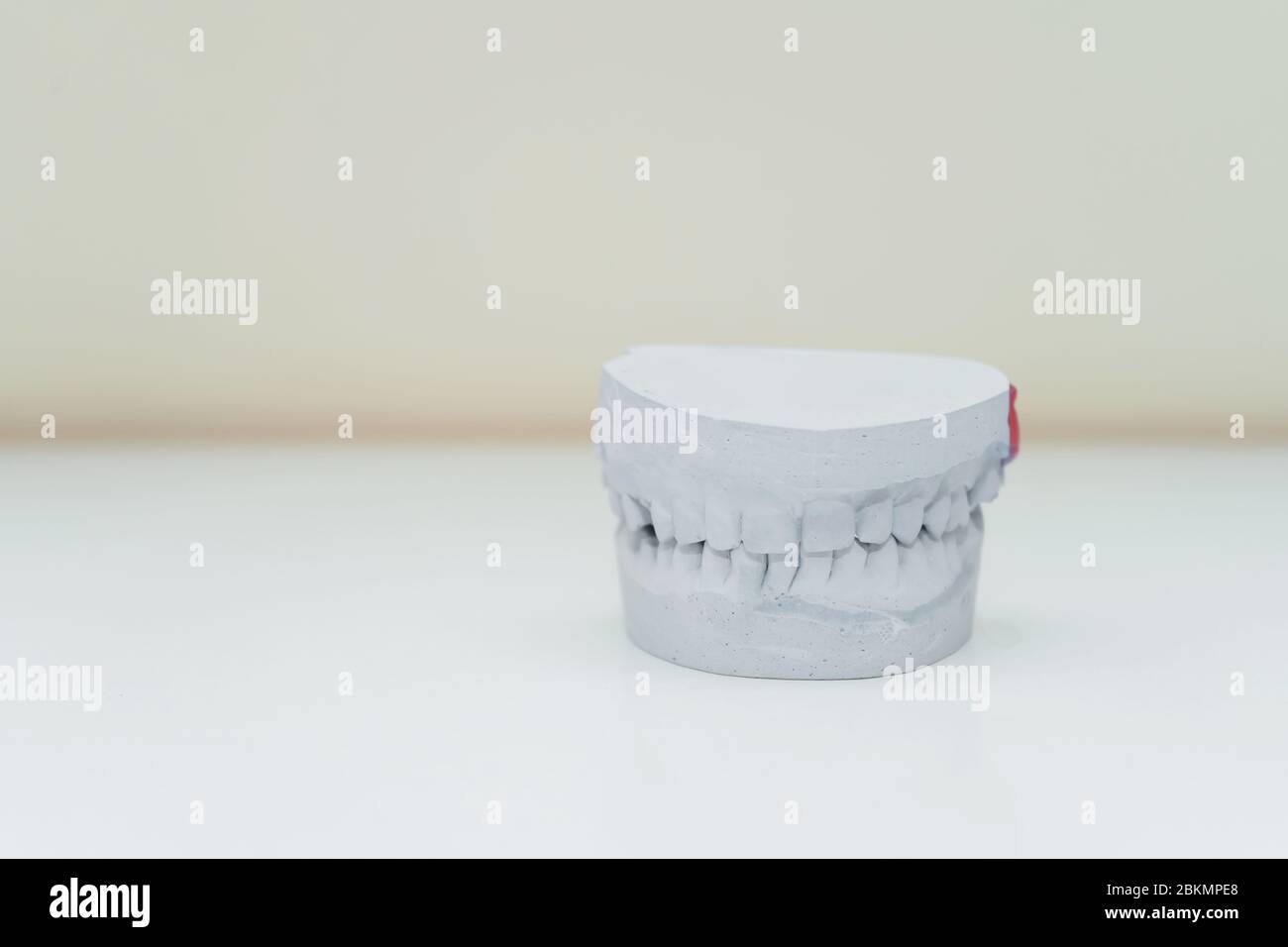 plaster cast of the jaw on a table in a bright room Stock Photo - Alamy