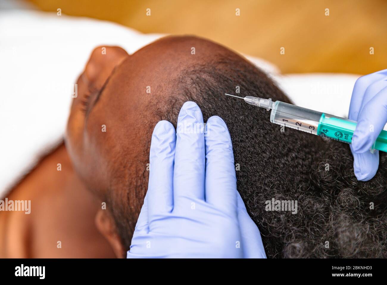 Doctor makes head beauty injection to female patient Stock Photo - Alamy