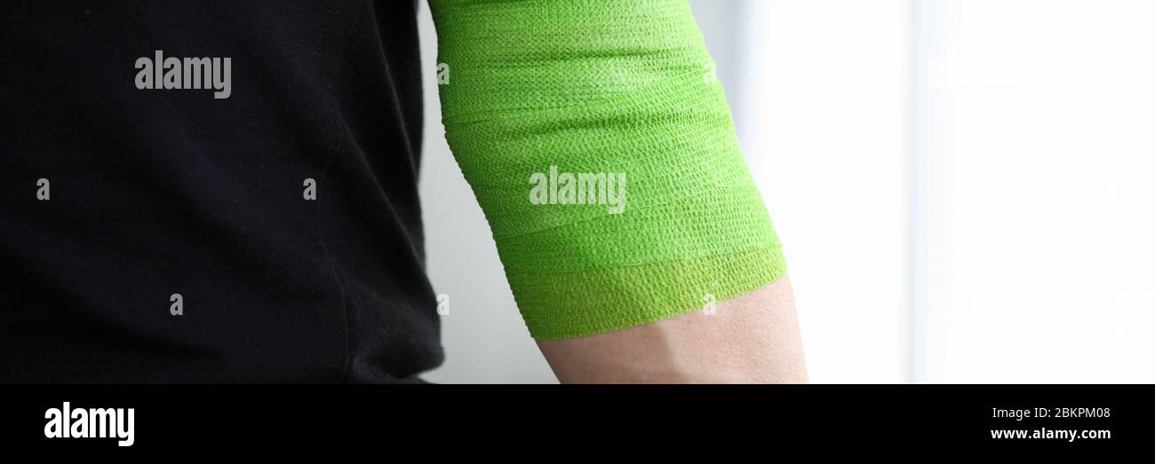 Elbow tendinitis hi-res stock photography and images - Alamy